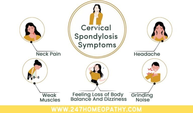 Cervical Spondylosis - 247homeopathy