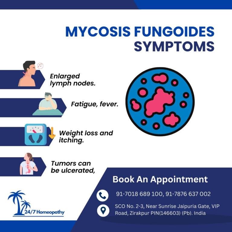 Mycosis Fungoides - 247homeopathy