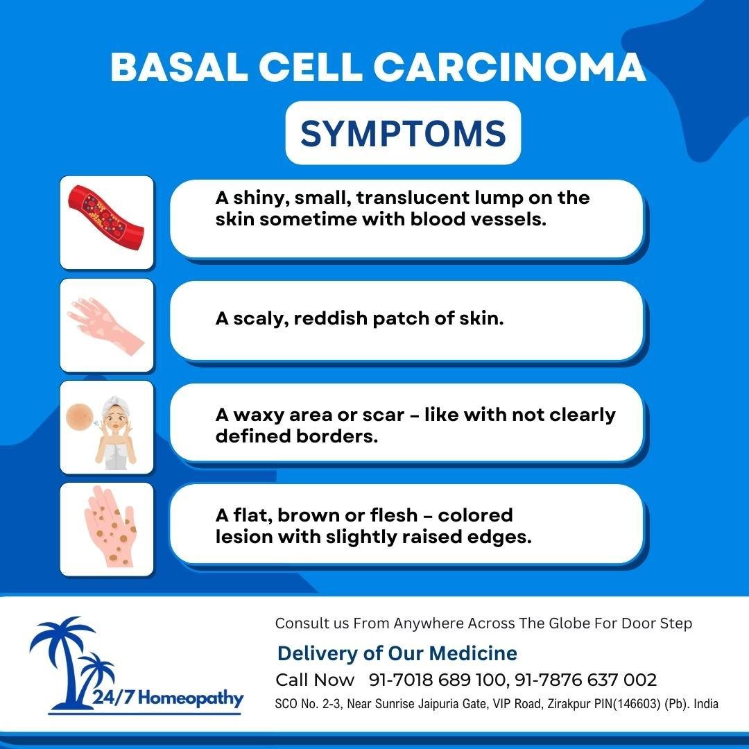 BASAL CELL CARCINOMA - 247homeopathy